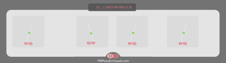 Brock String - All You Need To Know! - Mi Mundo Visual