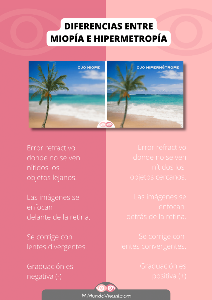 ¿Cuál Es La Diferencia Entre Hipermetropía Y Miopía? - Mi Mundo Visual