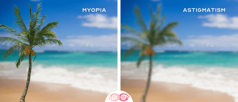 What is the difference between Myopia and Astigmatism? - Mi Mundo Visual